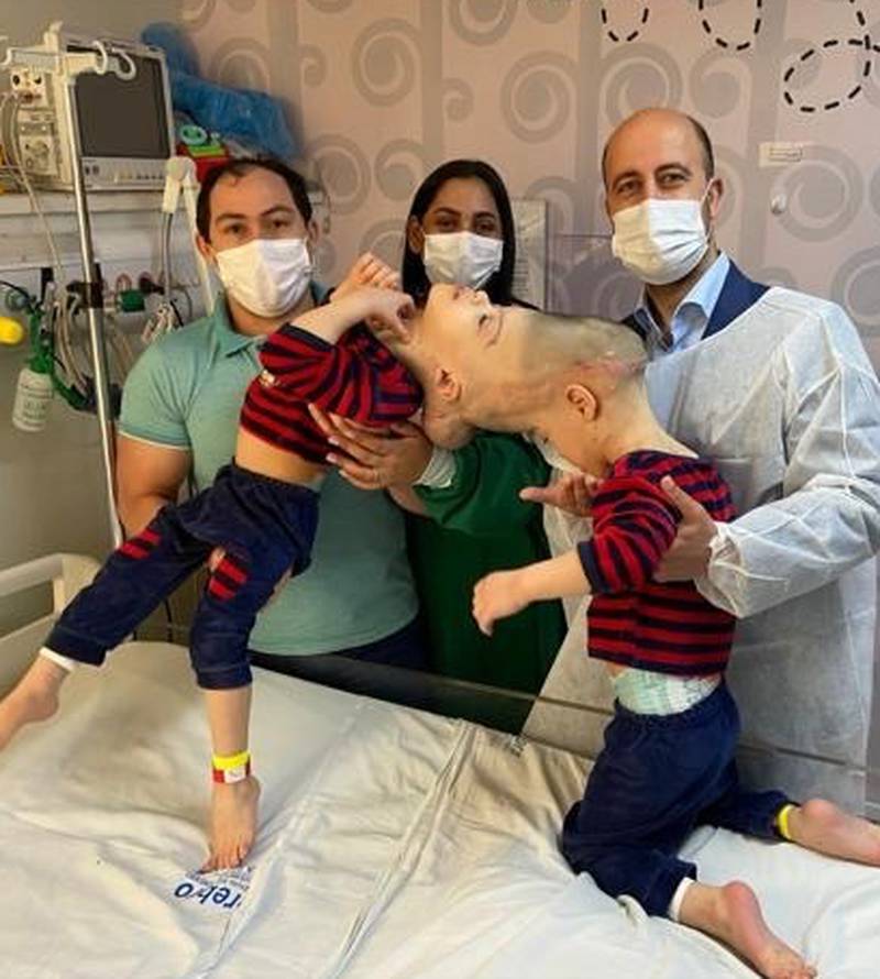 Connectivity aids successful surgery of craniopagus twins | GÉANT ...